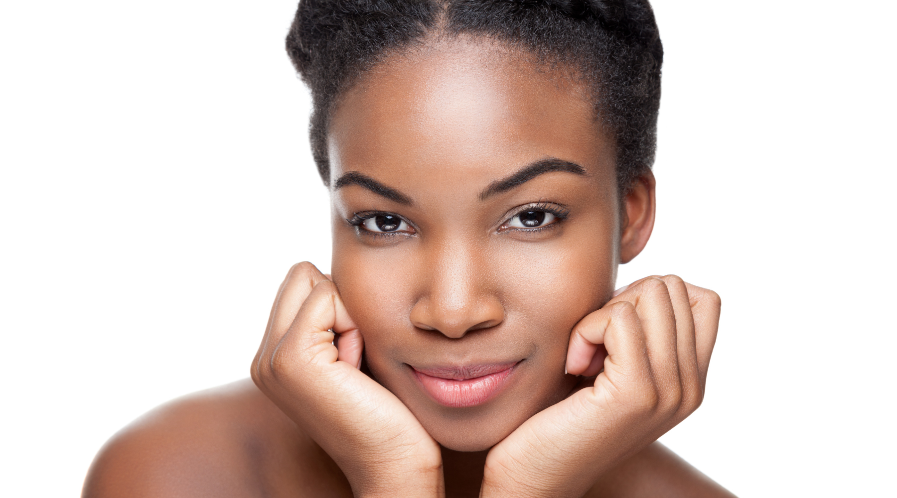 Viora Acne Clearance In Yuma - Craig Barrows DDS